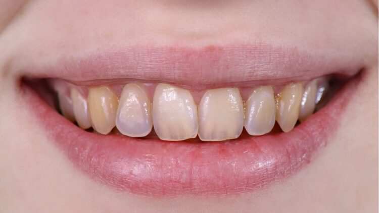 8 Most Common Dental Problems And Treatments — The Second Angle